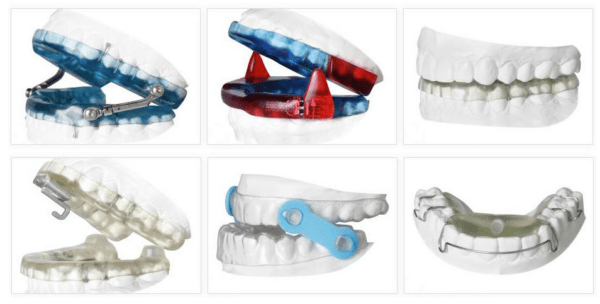 Understanding Mandibular Advancement Devices: A Solution for Snoring ...